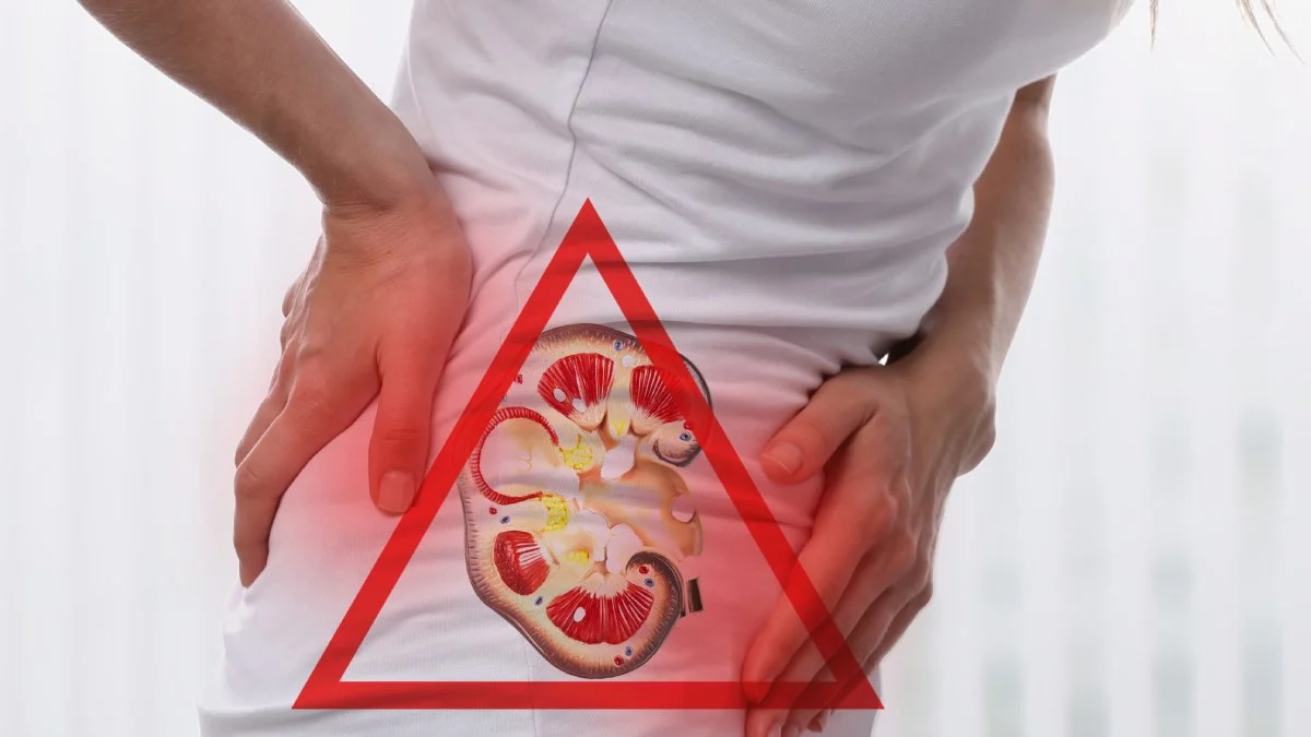 Pielonefritis - Enfermería Clínica